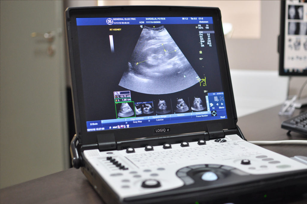 Υπέρηχοι κατ οίκον - Υπέρηχοι σώματος και αγγείων - Φορητός υπέρηχος