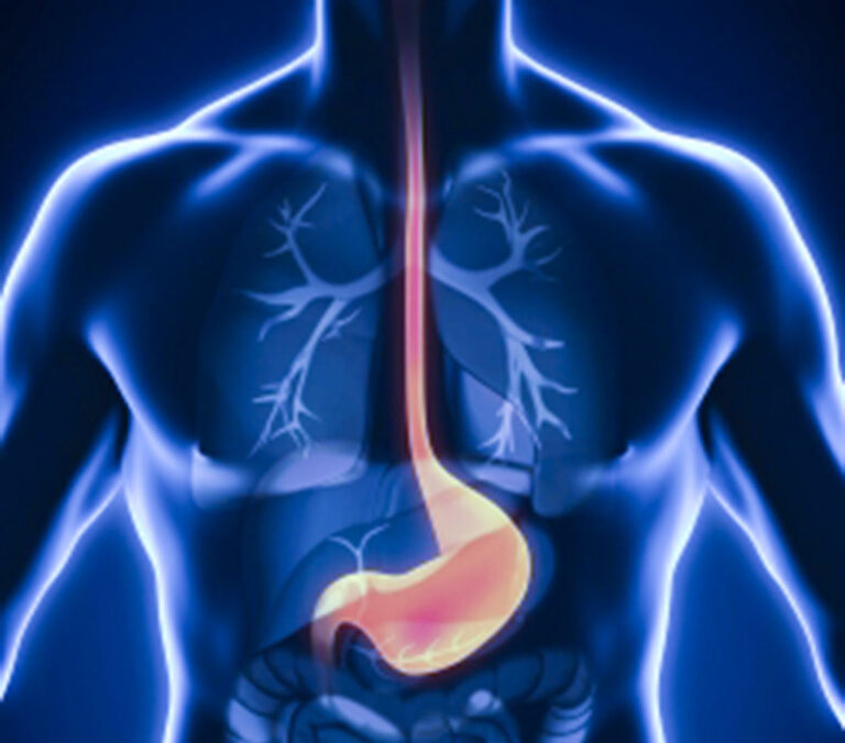 Γαστροσκόπηση - Πόντας Χρήστος Γαστρεντερολόγος Πετρούπολη